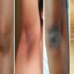 Como CLAREAR AXILAS em 20 MINUTOS - COMPROVADO